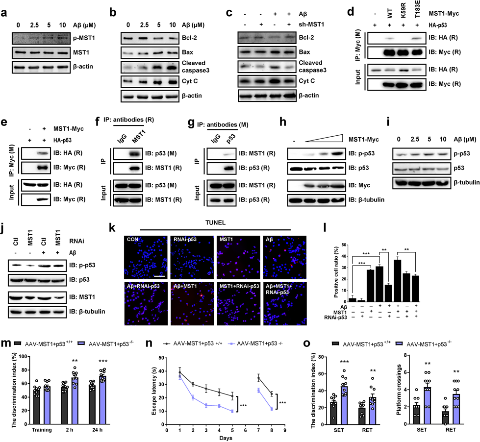 Prog Neurobiol | 南开大学张涛/吴世安团队发现阿尔茨海默病治疗的潜在新靶点
